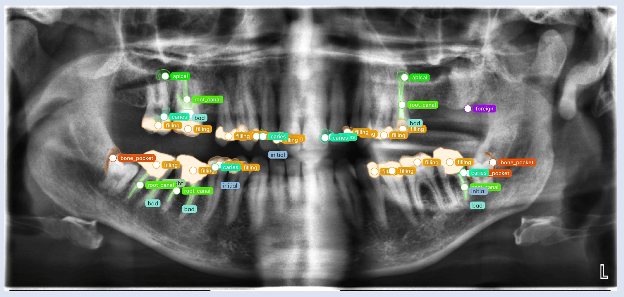 CheckDent AI | AI for dentistry