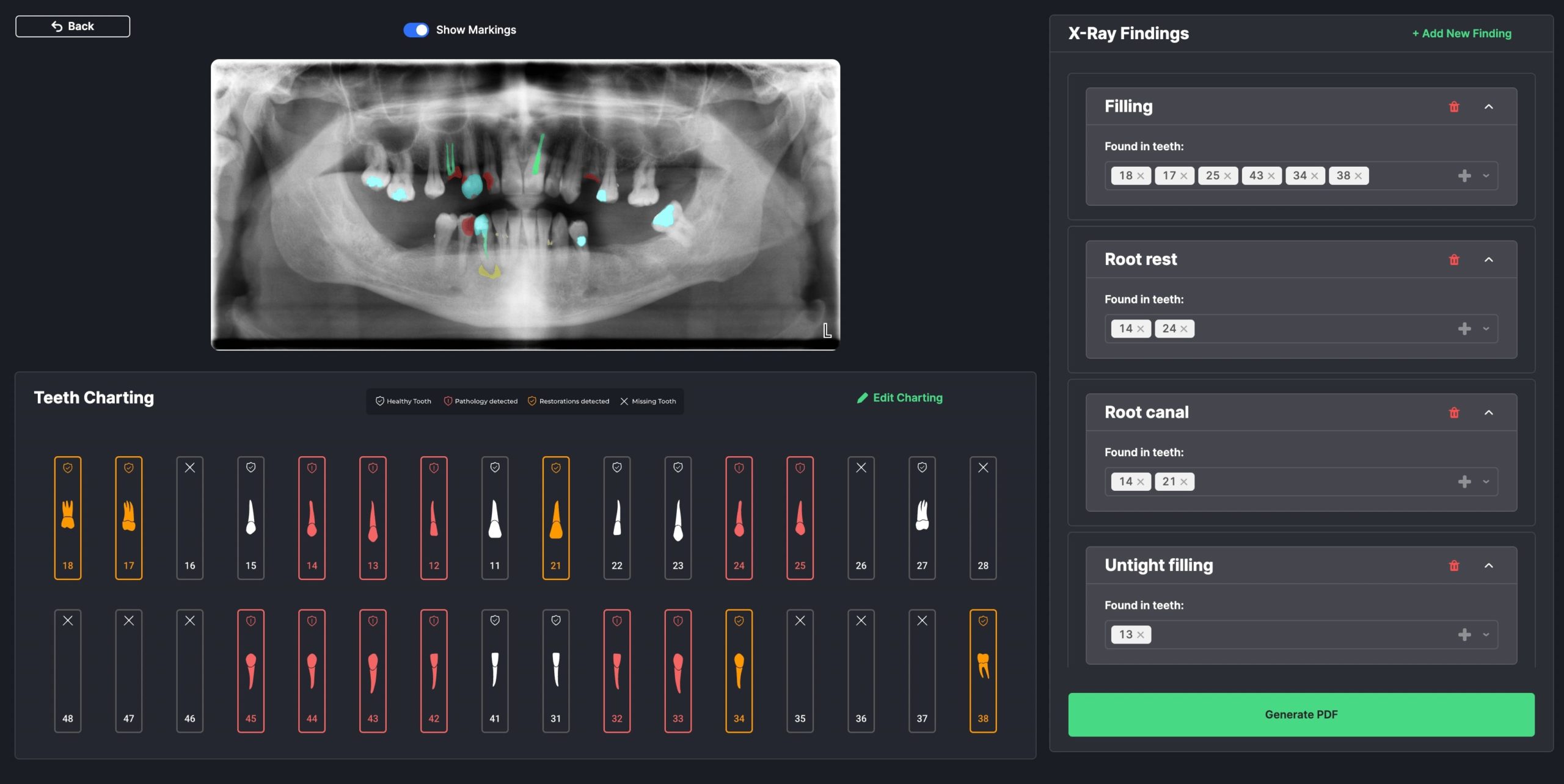 CheckDent AI | AI for dentistry